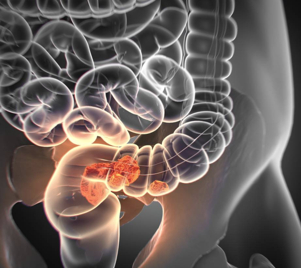 Fanning Logo - Launceston Gastroenterology - Dr Scott Fanning